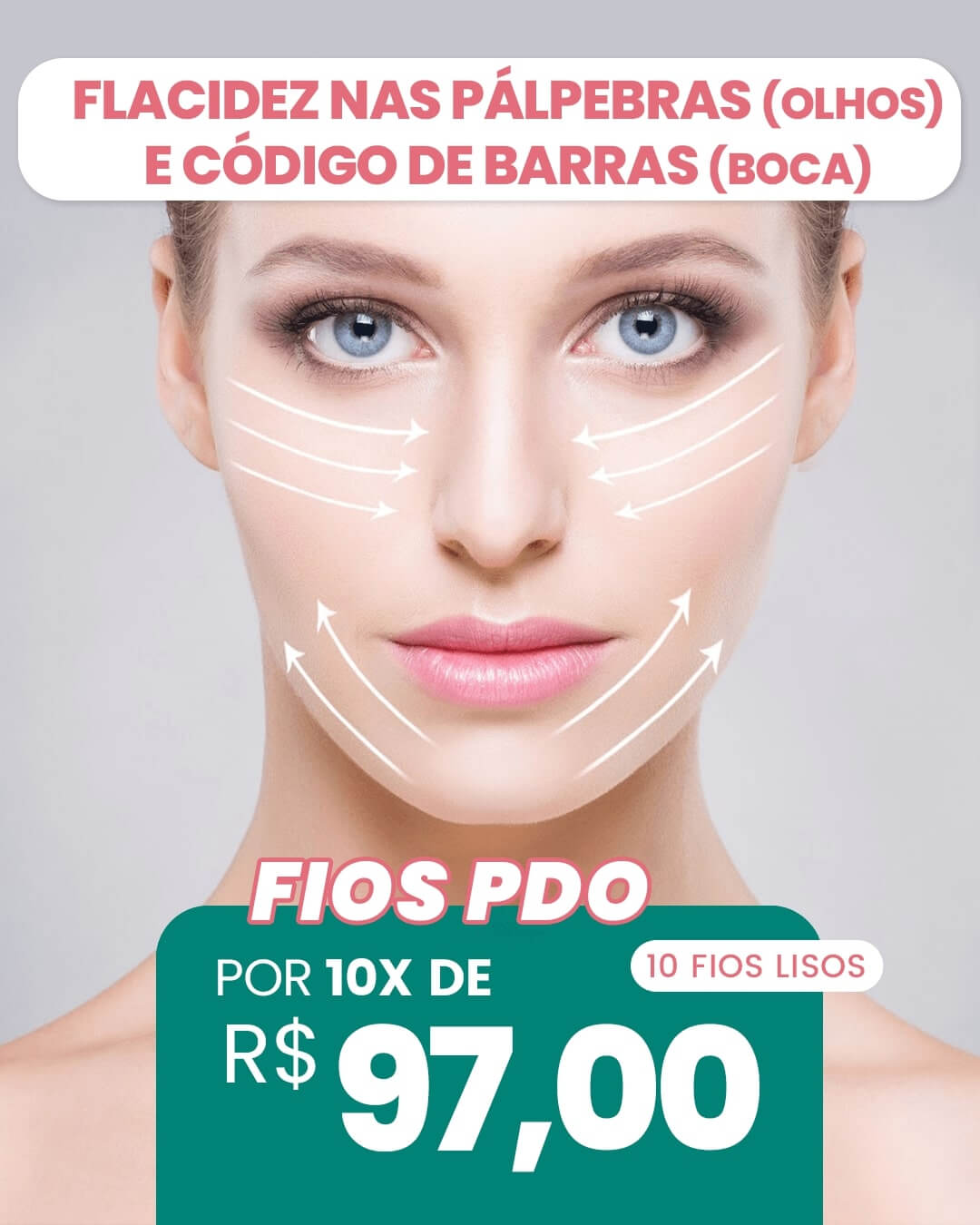 Fios de PDO – Belle Vie